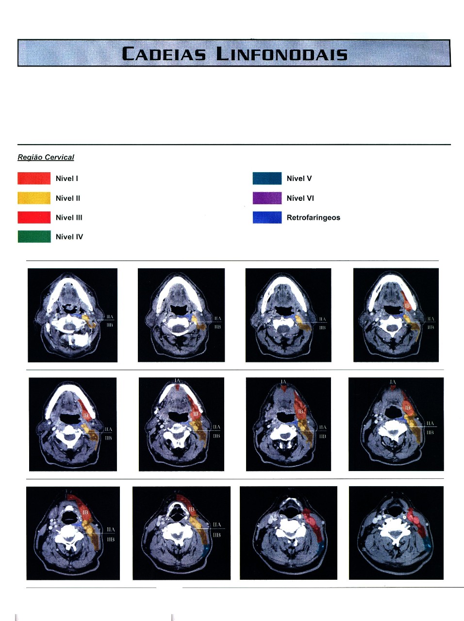 Cadeias linfonodais cervicais :: Referências Radiológicas