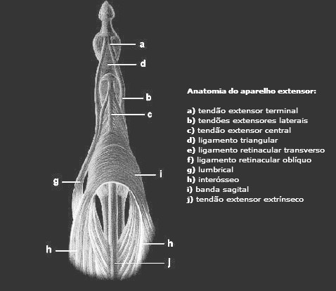Aparelho extensor dos dedos :: Referências Radiológicas